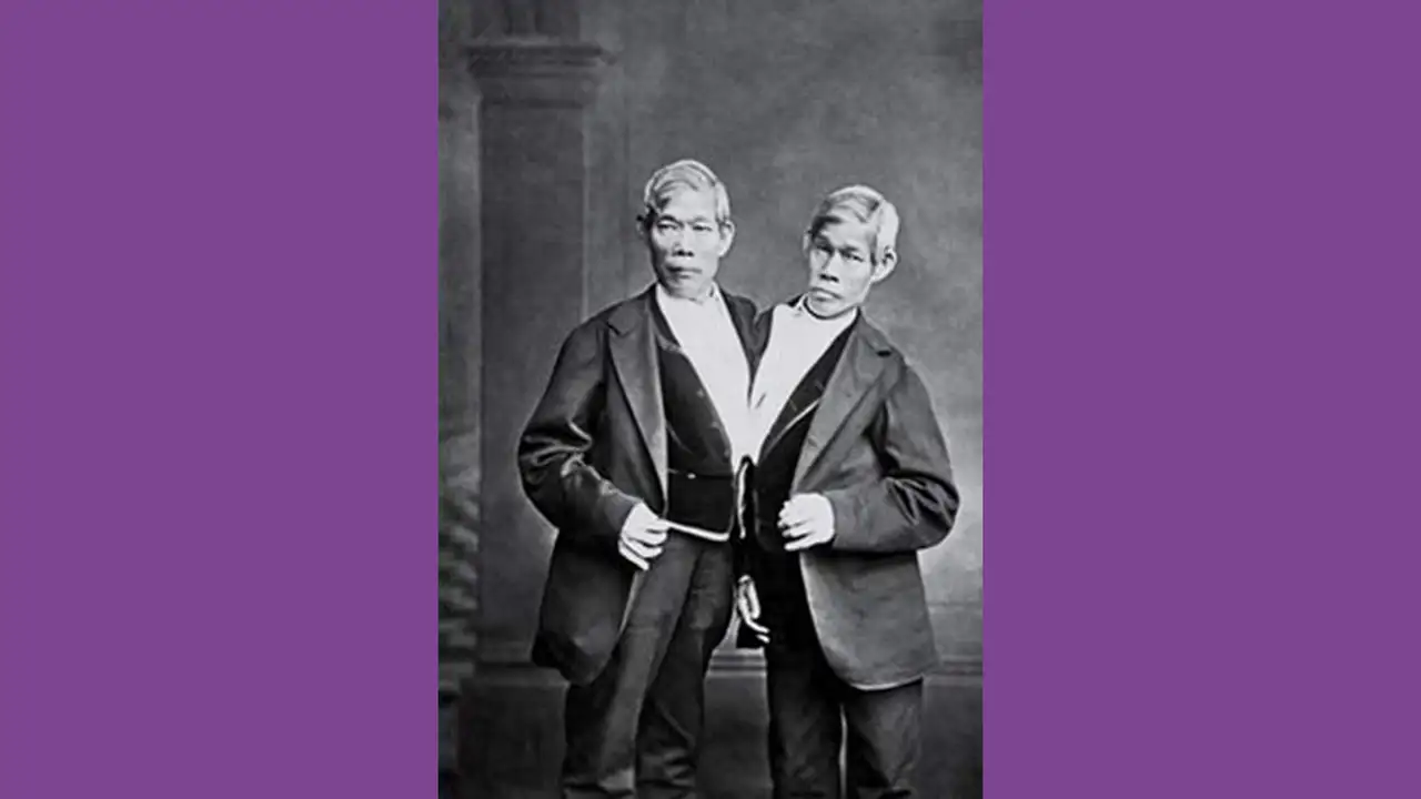 Listen to The Original Siamese Twins: An American Story